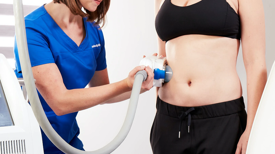 Top 5 Benefits Of CoolSculpting Inspirational Bodies